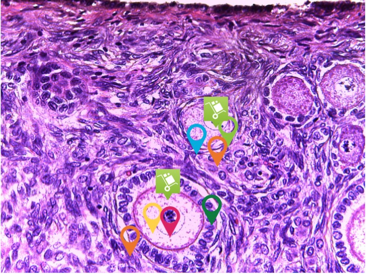 follicules primordiaux et primaires