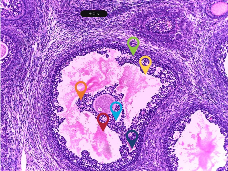 follicule de De Graaf