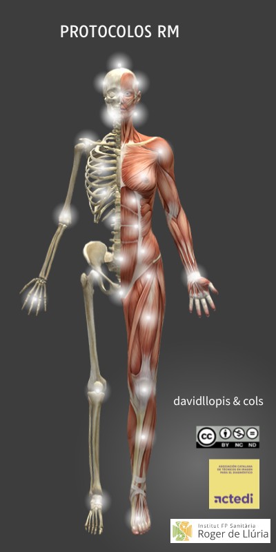 RM protocolos | Genially