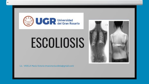 UGR tecnicas 2 (ESC) | Genially