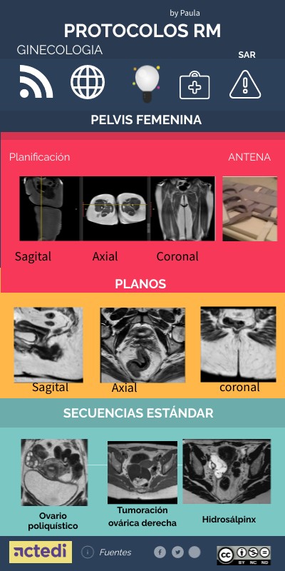 pelvis-gine | Genially
