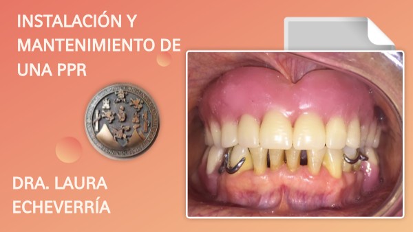 Instalación y Mantenimiento de PPR | Genially