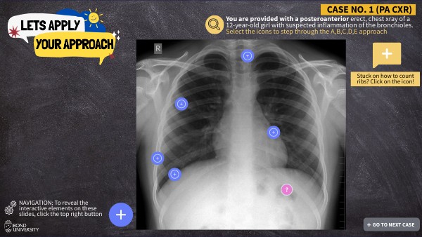 Week 3 CXR Cases & Answers | Genially
