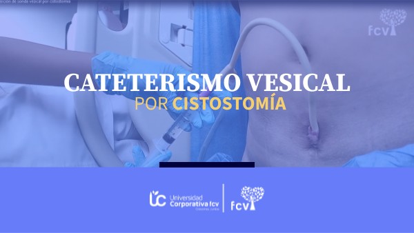 Cateterismo vesical por cistostomía | Genially