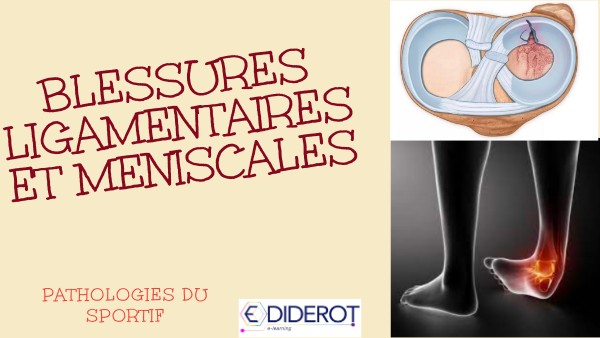 BLESSURES LIGAMENTAIRES ET MENISCALES