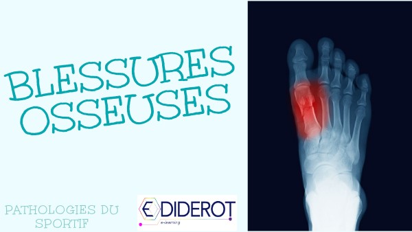BLESSURES OSSEUSES / FRACTURES | Genially