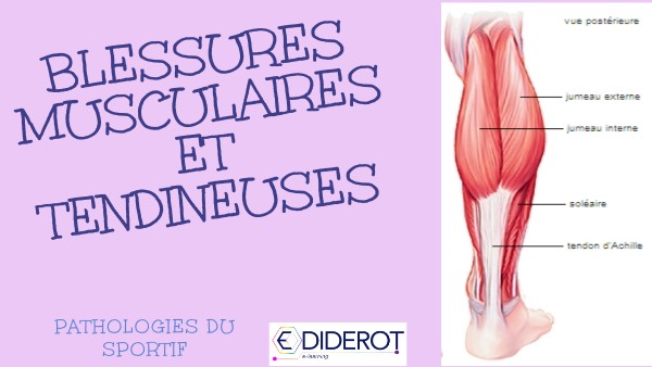 BLESSURES MUSCULAIRES ET TENDINEUSES | Genially
