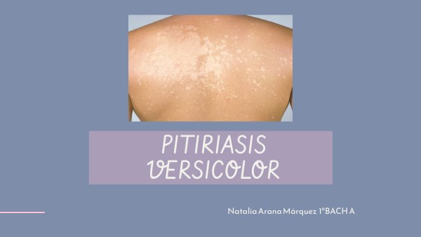 Pitiriasis versicolor | Genially