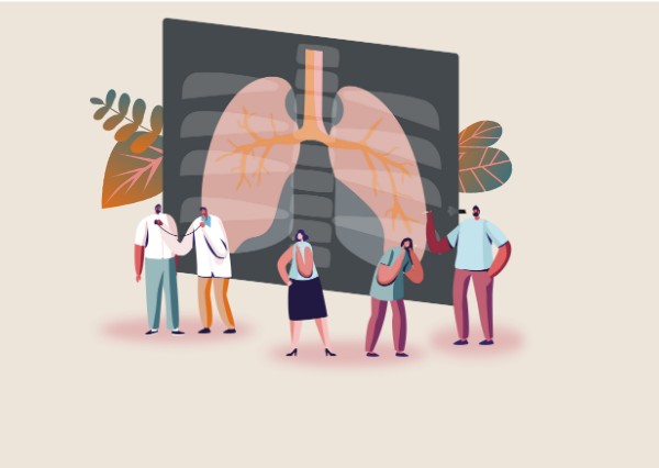 Copia - 24274_INT_GSK ASMA