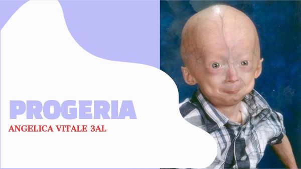 PROGERIA