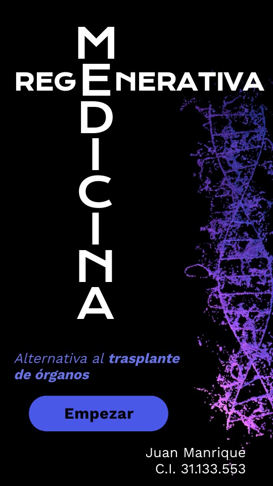 Infografía int - Juan Manrique