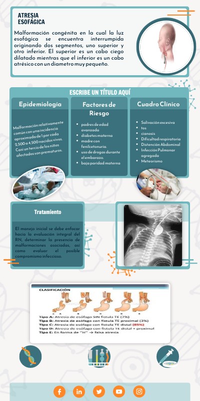 Infografia Atresia Esofágica | Genially