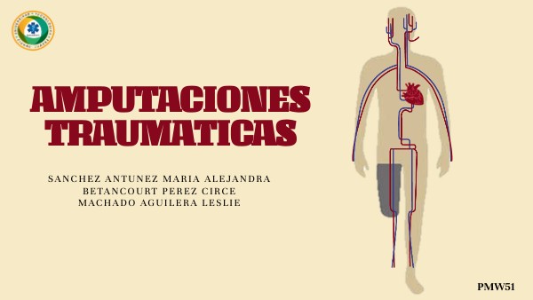 Amputaciones Traumaticas | Genially