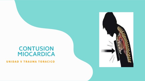contusion miocardica | Genially
