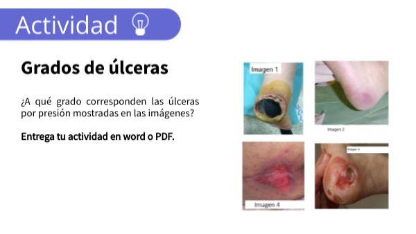 Grados de úlceras