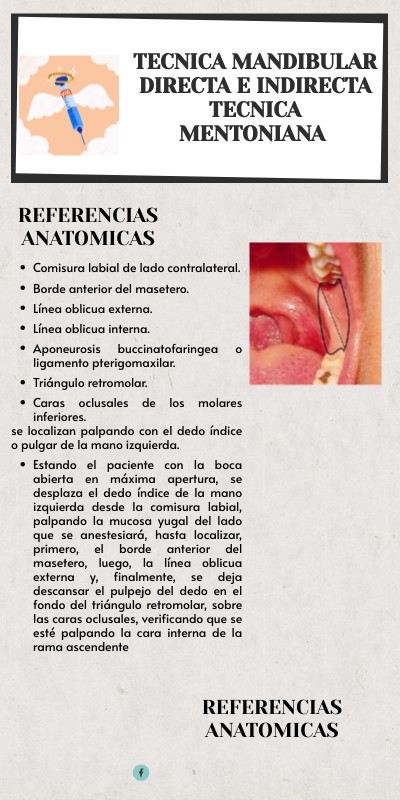 TECNICA MANDIBULAR DIRECTA E INDIRECTATECNICA MENTONIANA