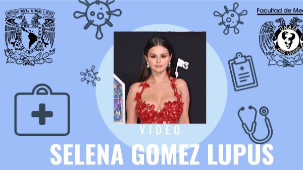 Selena Gomez Lupus