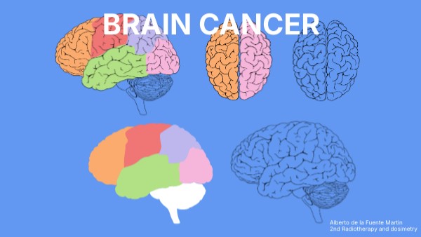 Brain cancer | Genially