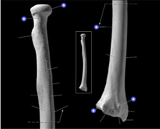 right radius posterior | Genially