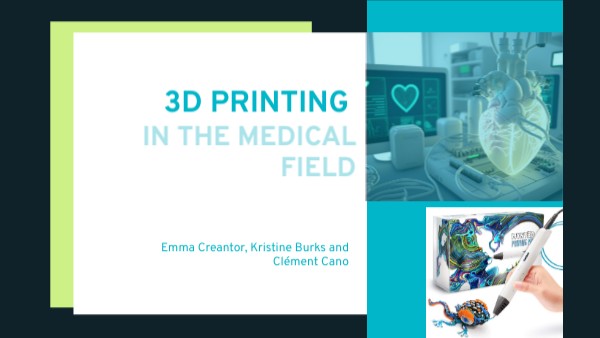 impression 3d | Genially