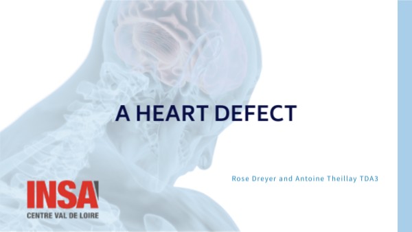 the pacemaker | Genially