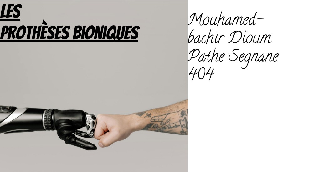 Les prothèses bioniques | Genially