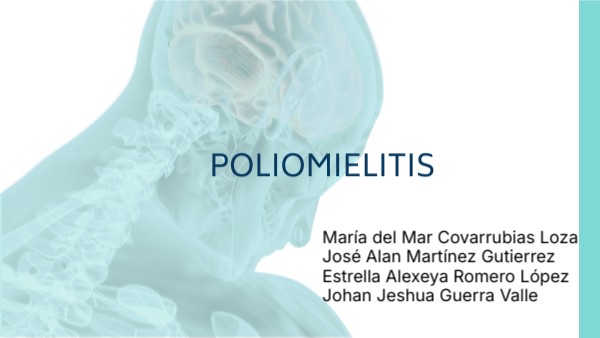 POLIOMIELITIS | Genially