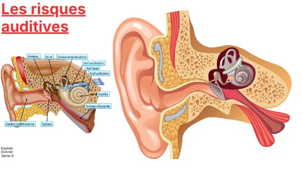Les risques auditives | Genially