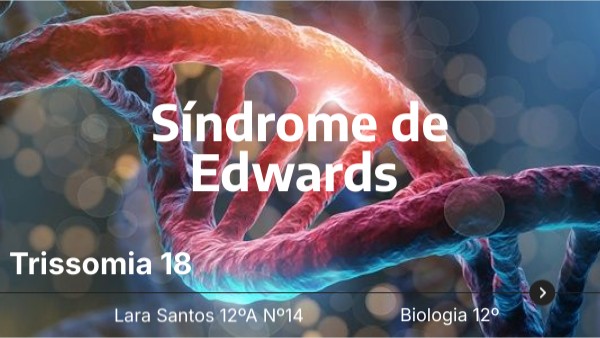 Síndrome de Edwards | Genially
