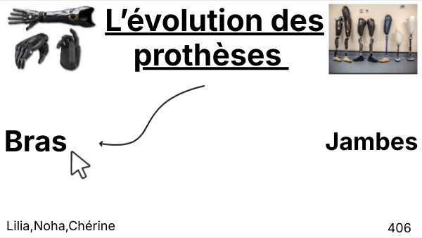 L’évolution des prothèses | Genially