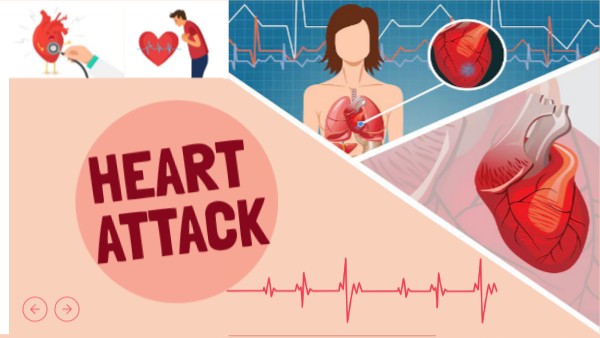 heart attack | Genially