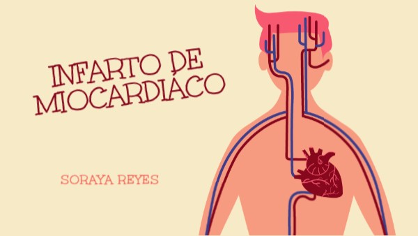 INFARTO de MIOCARDIÁCO | Genially