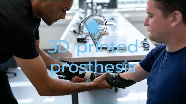 3D printed prosthesis | Genially