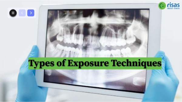 Types of Exposure Techniques | Genially