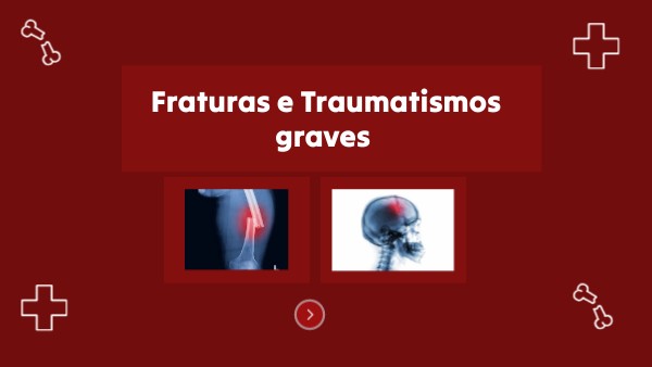Fraturas e Traumatismos graves | Genially